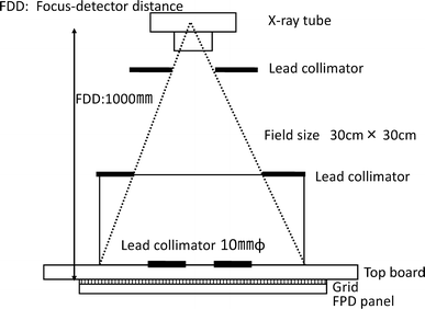 Comparison of anti-scatter grids for digital imaging with use of a ...