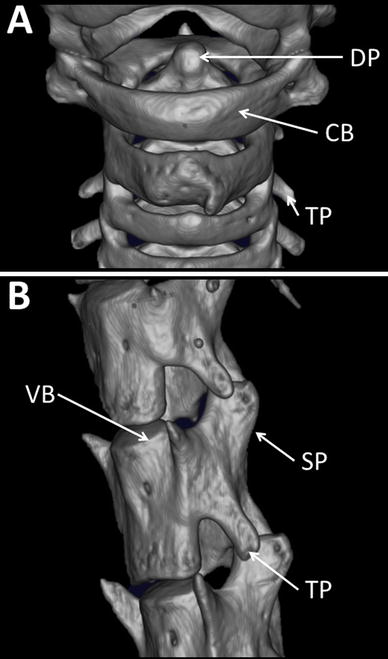 Visualization of mouse spinal cord microscopic structures by use of ex ...
