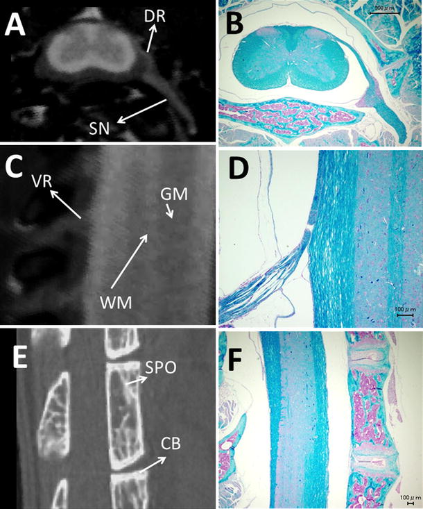 Visualization of mouse spinal cord microscopic structures by use of ex ...