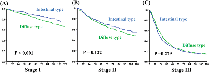 Clinicopathological Variation of Lauren Classification in Gastric ...
