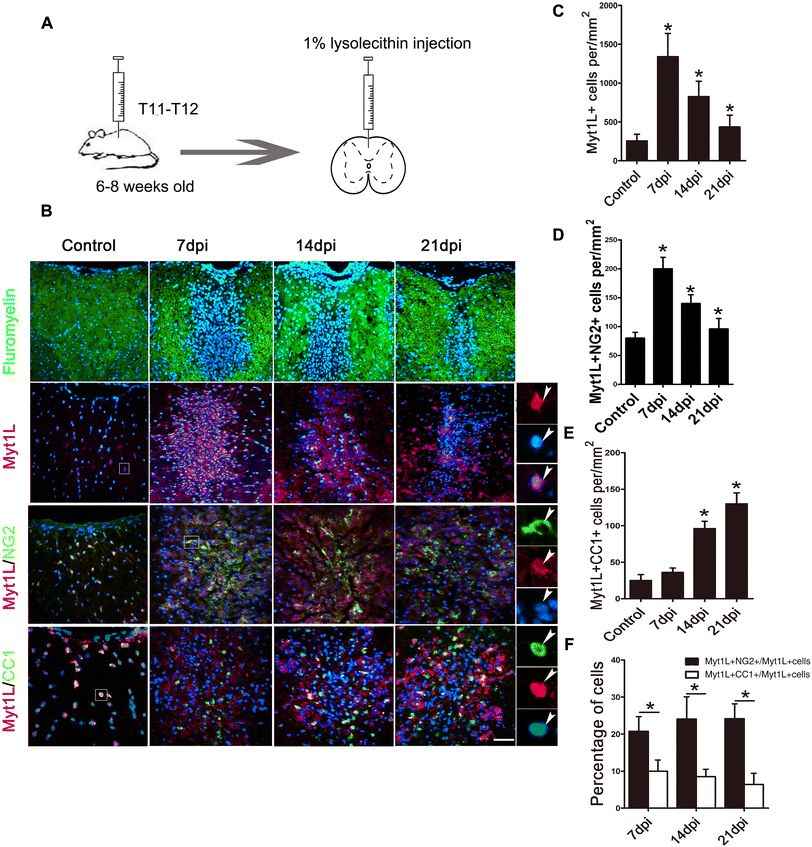 Myt1L Promotes Differentiation of Oligodendrocyte Precursor Cells and ...