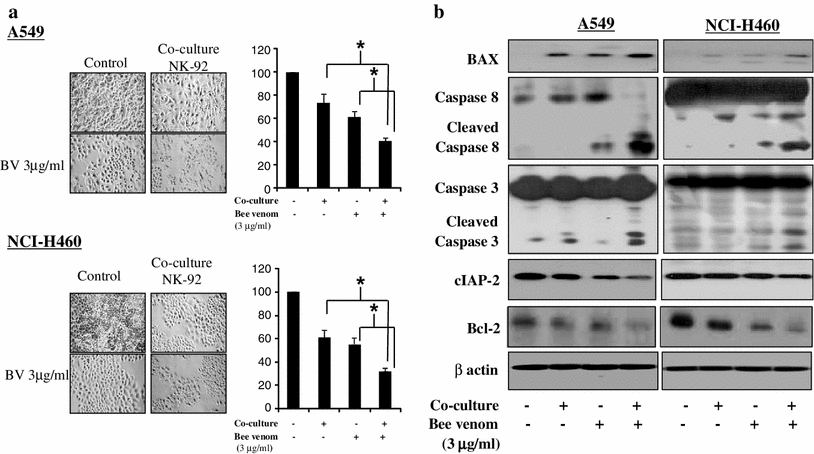 Co-culture with NK-92MI cells enhanced the anti-cancer effect of bee venom on NSCLC cells by ...