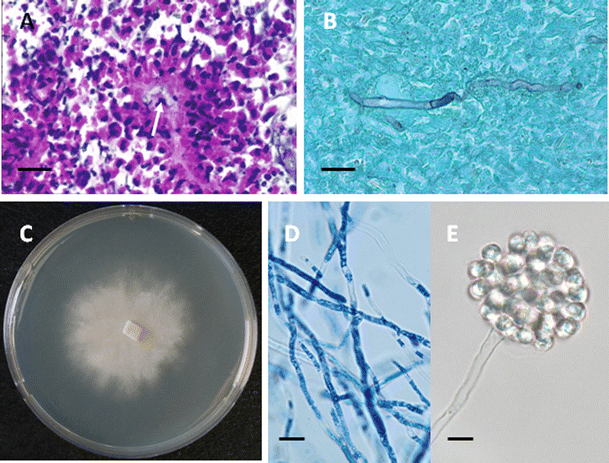 The Mammalian Pathogenic Oomycetes | SpringerLink