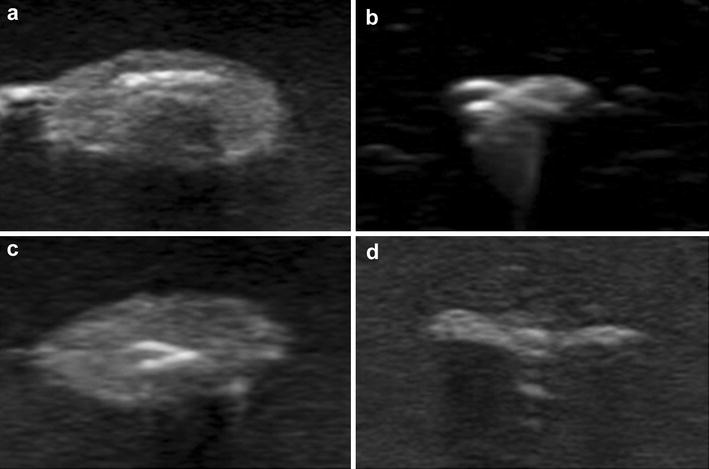 Evaluation of the sonographic visibility and sonographic appearance of ...