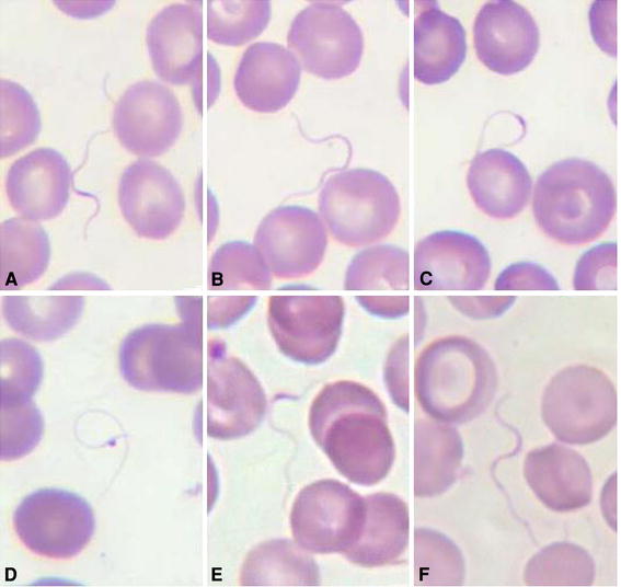 Exflagellated Microgametes of Plasmodium Vivax in Human Peripheral ...