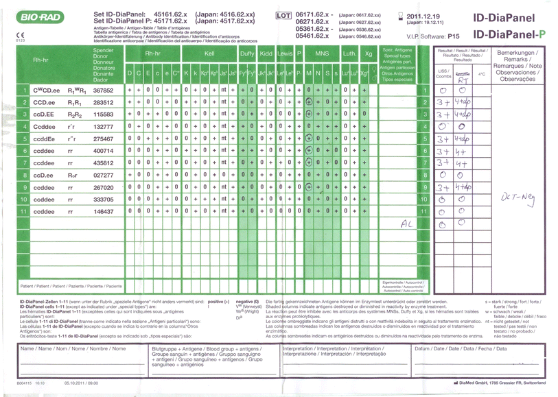 Anti-M Antibody in Solid Tumors-Two Case Reports | SpringerLink