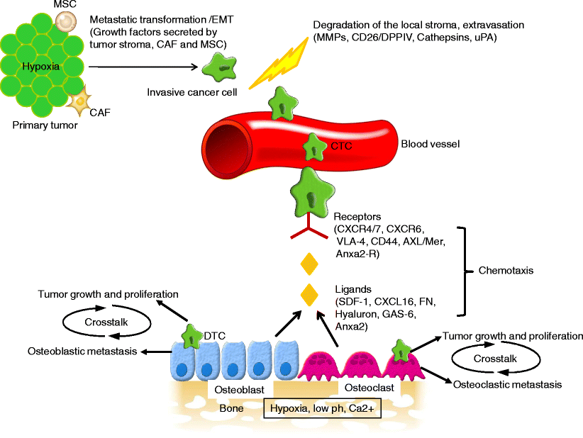 Homing of Cancer Cells to the Bone | SpringerLink