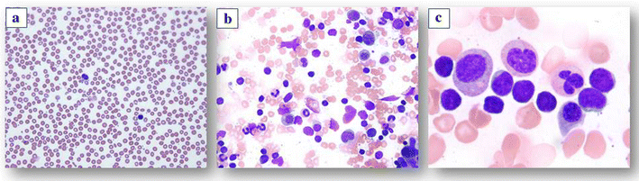 Bone marrow failure syndromes, a practical approach to diagnosis ...