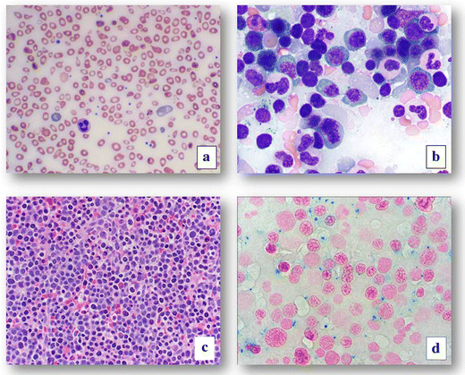 Bone marrow failure syndromes, a practical approach to diagnosis ...