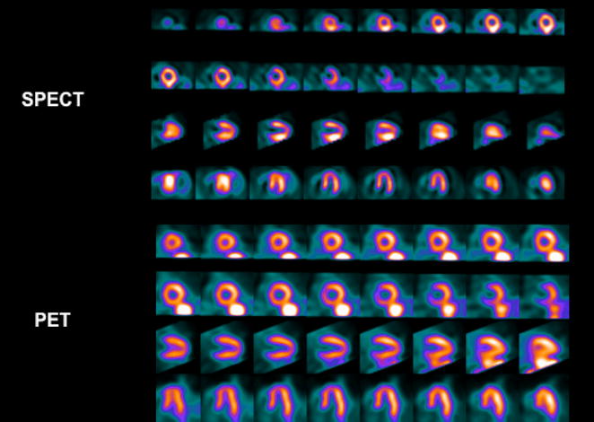 Advantages and disadvantages of PET and SPECT in a busy clinical ...