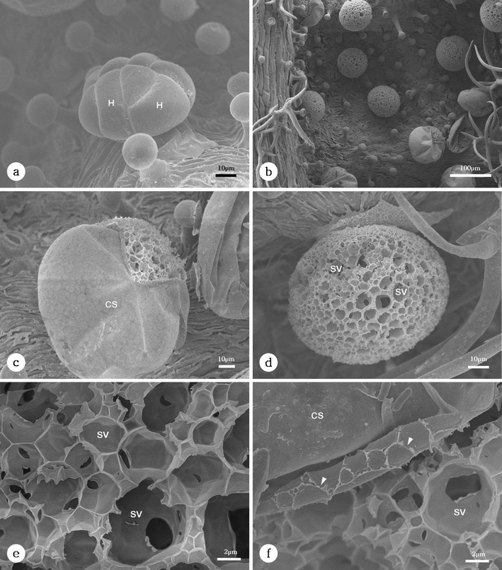 Developmental Ultrastructure of Glandular Trichomes of Rosmarinus ...