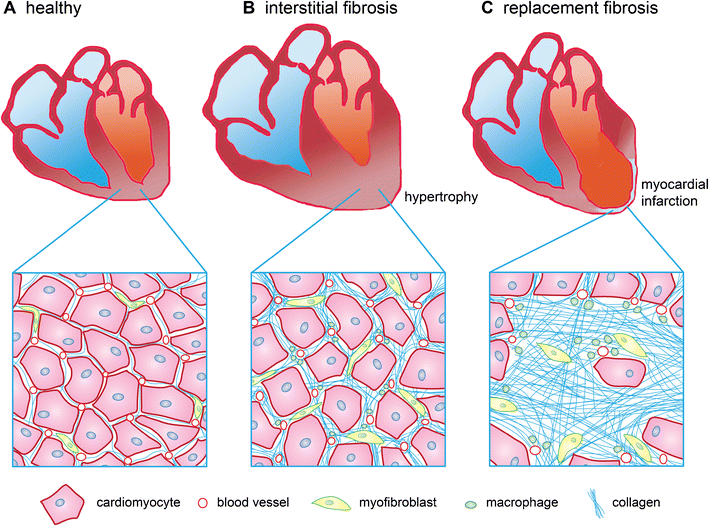 Contrast-Enhanced T1-Mapping MRI for the Assessment of Myocardial ...