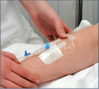 Medicatie toedienen bij een perifeer infuus via een driewegkraantje ...