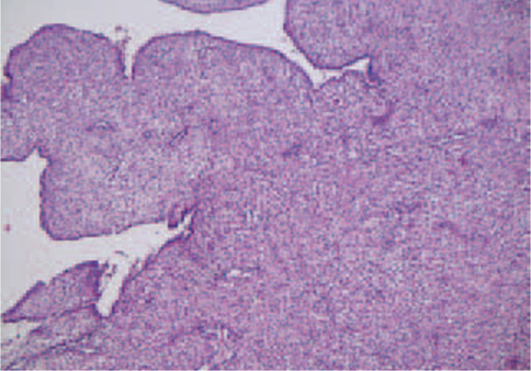 Decidual cast | SpringerLink