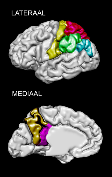 De rol van de pariëtaalkwab in de vroege fase van de ziekte van ...