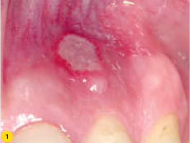 AFTEN | SpringerLink