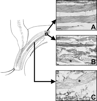 The human superior tarsal muscle (Müller’s muscle): a morphological ...