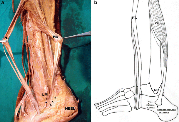 The peroneus quartus muscle: clinical correlation with evolutionary ...