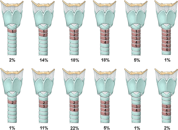 The location and morphometry of the thyroid isthmus in adult Korean ...