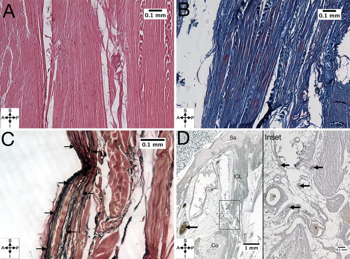 The anatomy of the sacrococcygeal cornual region and its clinical ...