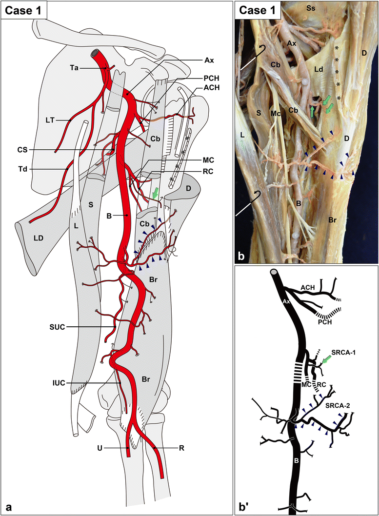 Reevaluation of the superior radial collateral artery in the human ...