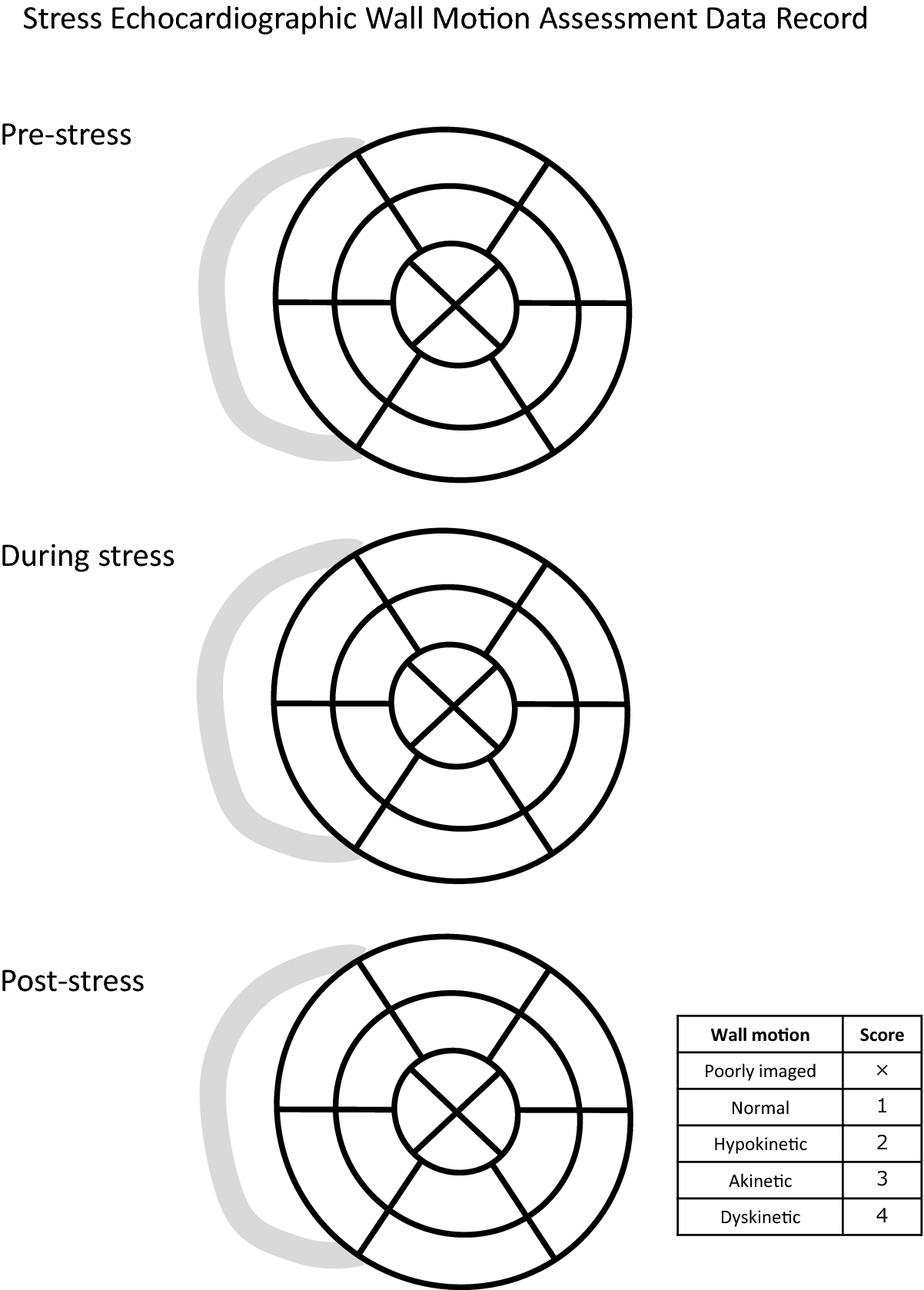 Practical guidance for the implementation of stress echocardiography ...