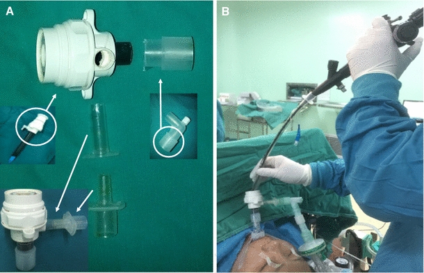 Continuous ventilation using a modified laparoscopic port and laryngeal ...