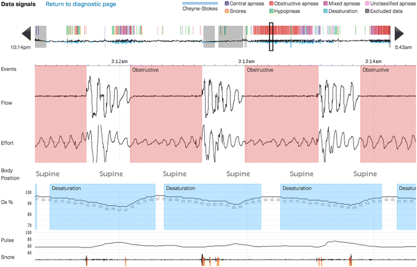 Interpretation of sleep studies for patients with sleep-disordered ...