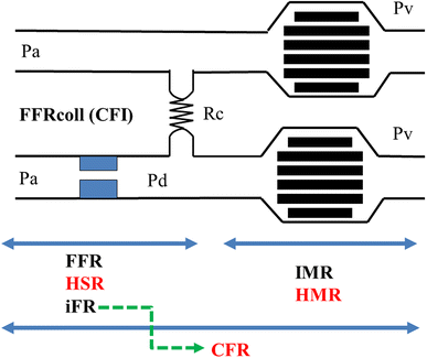 FFR and iFR guided percutaneous coronary intervention | SpringerLink
