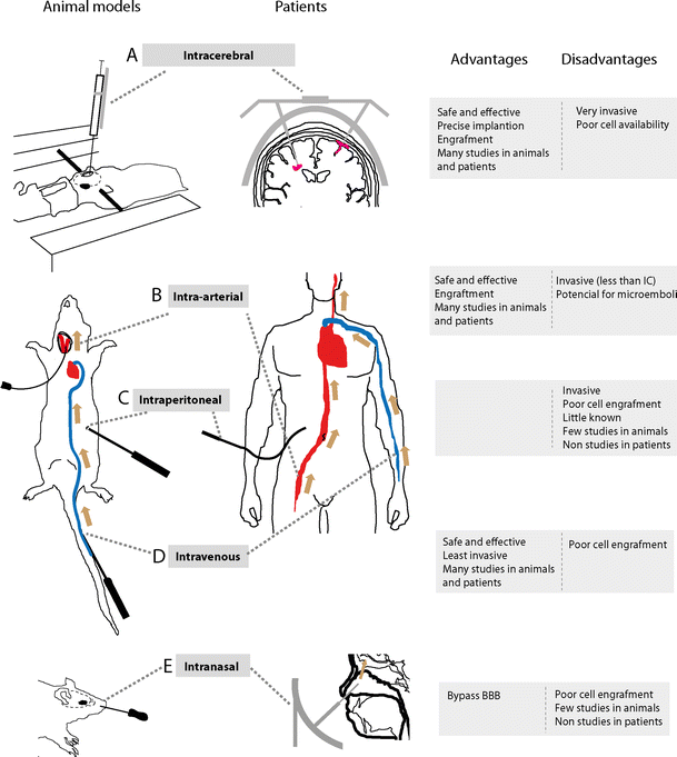 Stem Cell Therapy and Administration Routes After Stroke | SpringerLink