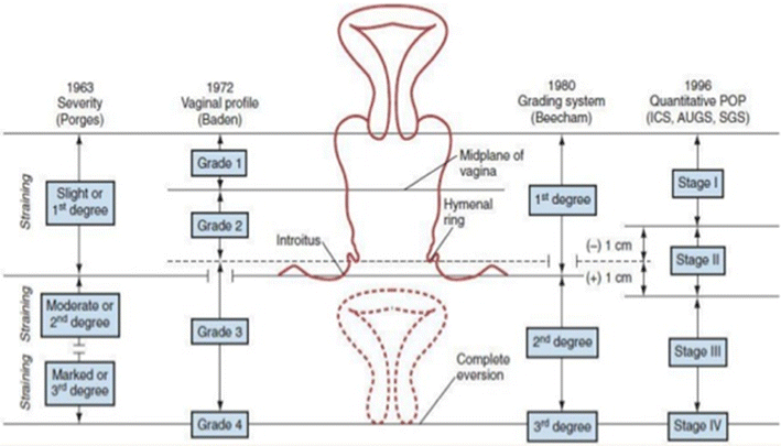 Relationship Of Decubitus Ulcer On Cervix In Pelvic Organ Prolapse With Pop Q Staging Springerlink