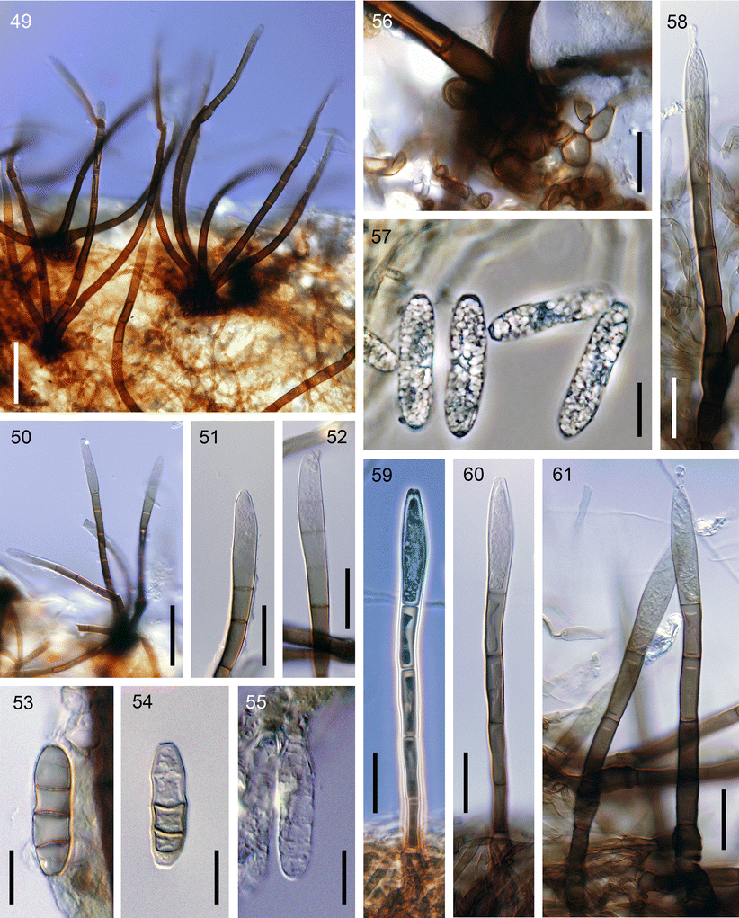 The new hyphomycete genera Brachyalara and Infundichalara, the similar ...