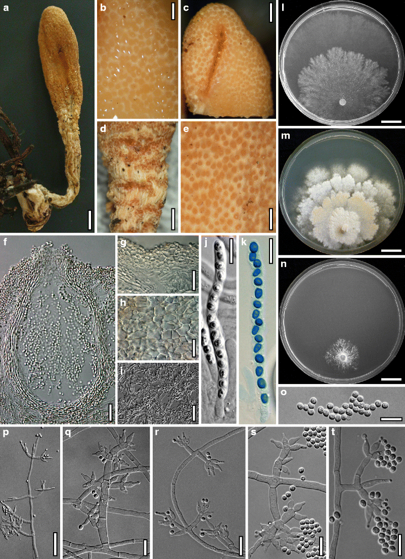 European species of Hypocrea part II: species with hyaline ascospores ...