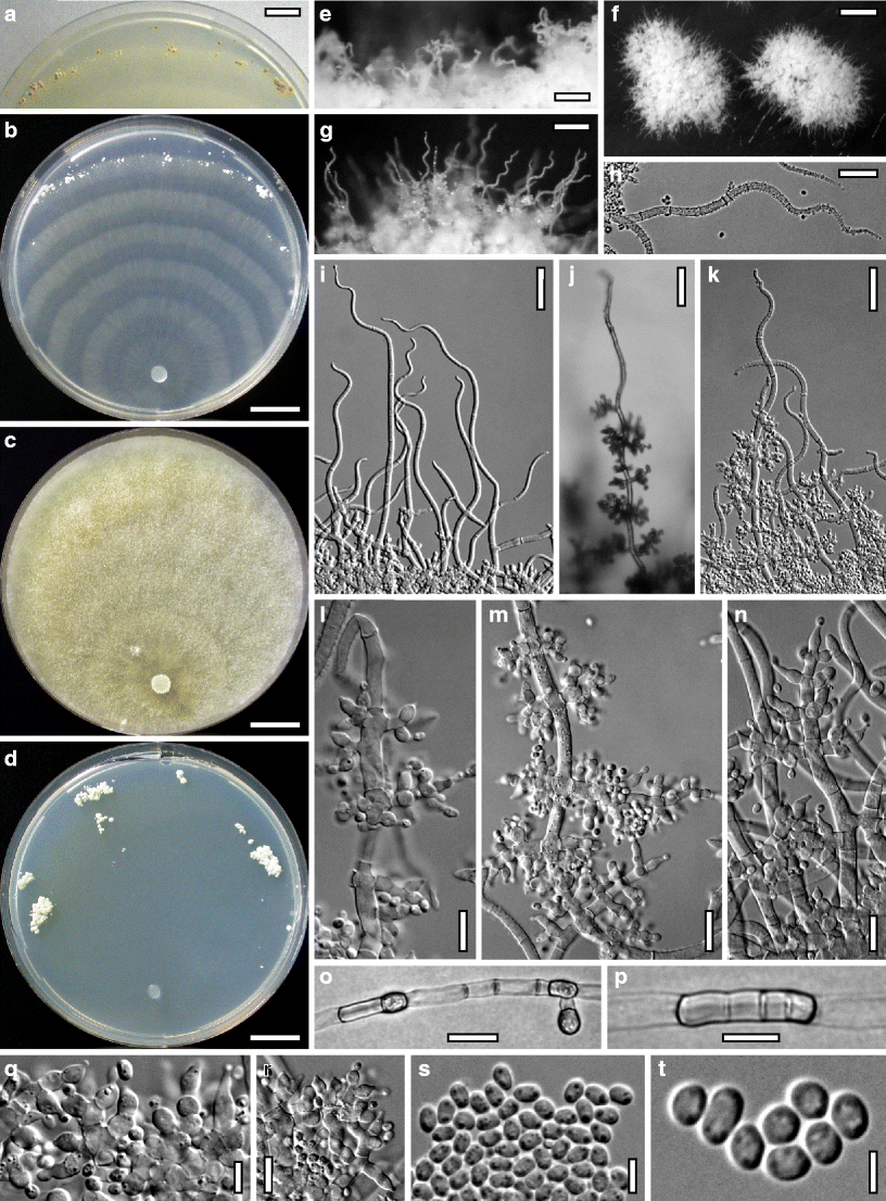 European species of Hypocrea part II: species with hyaline ascospores ...