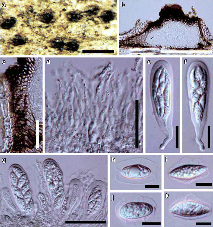 Families of Dothideomycetes | SpringerLink