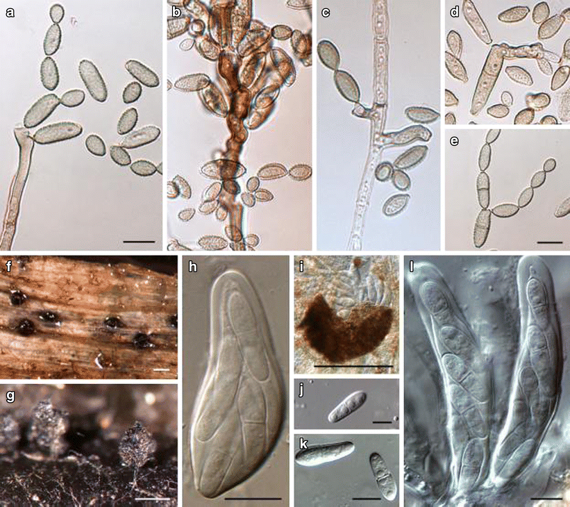 Families of Dothideomycetes | SpringerLink