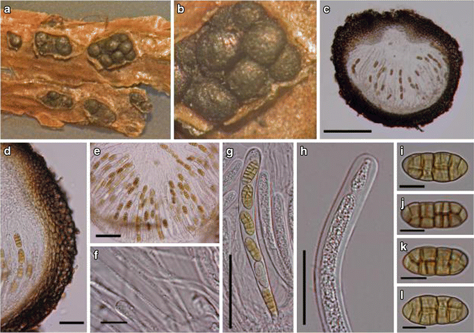 Families of Dothideomycetes | SpringerLink