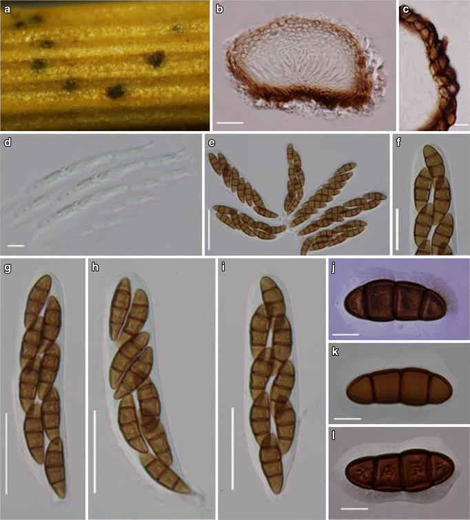 Families of Dothideomycetes | SpringerLink