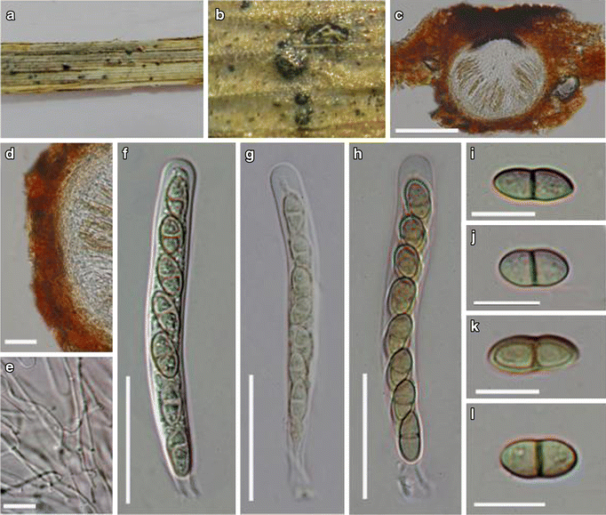 Families of Dothideomycetes | SpringerLink