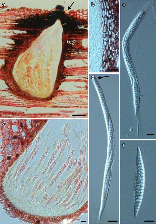 Families of Dothideomycetes | SpringerLink