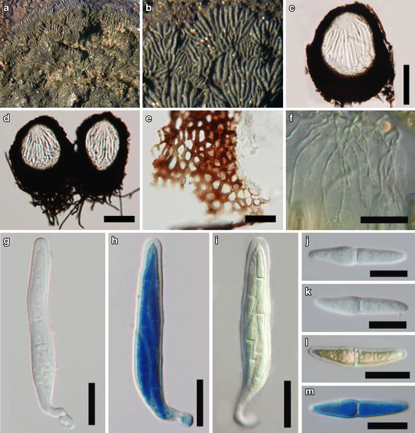 Families of Dothideomycetes | SpringerLink