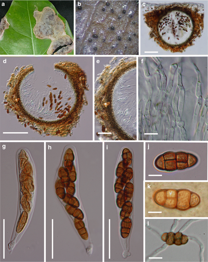 A molecular phylogenetic reappraisal of the Didymosphaeriaceae ...