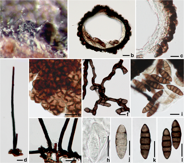 Meliolales | SpringerLink