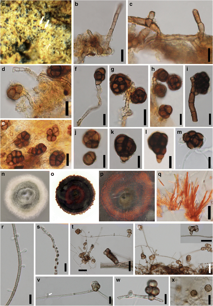 Fungal diversity notes 111–252—taxonomic and phylogenetic contributions ...