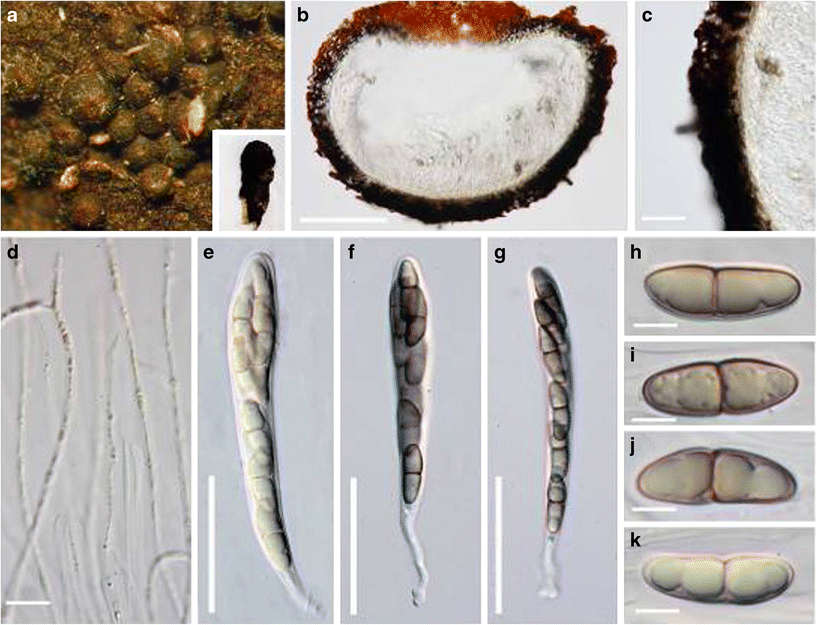 Fungal diversity notes 111–252—taxonomic and phylogenetic contributions ...