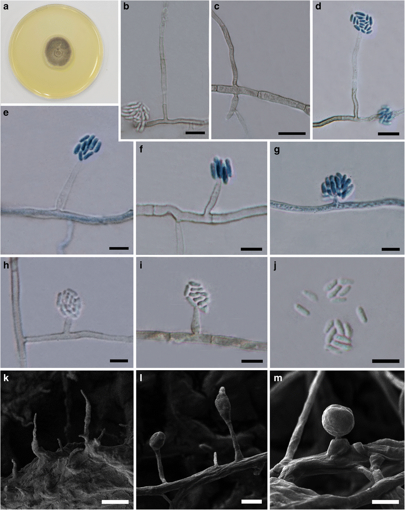 Fungal diversity notes 111–252—taxonomic and phylogenetic contributions ...