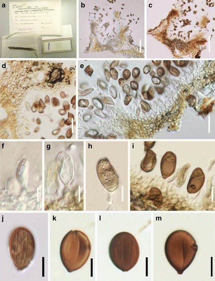 Taxonomy and phylogeny of dematiaceous coelomycetes | SpringerLink