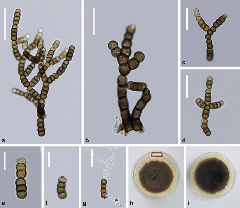 The families Distoseptisporaceae fam. nov., Kirschsteiniotheliaceae ...