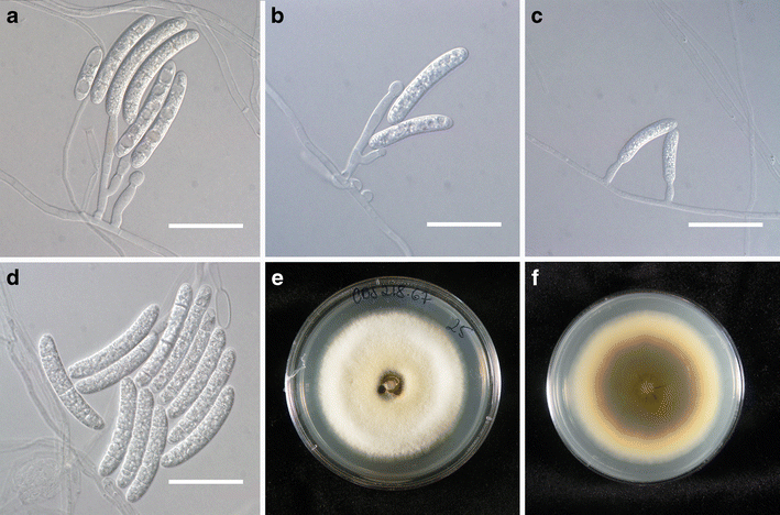 The genus Thelonectria ( Nectriaceae, Hypocreales, Ascomycota) and ...