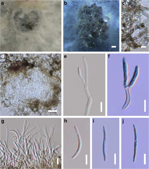 Fungal diversity notes 253–366: taxonomic and phylogenetic ...